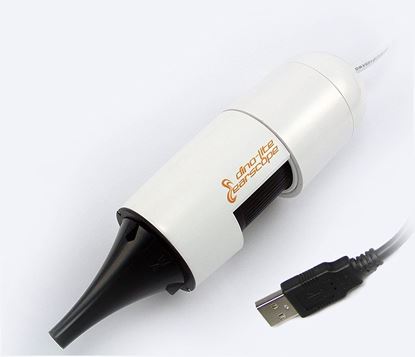 Earscope Economy Hi-Resolution USB Compact Video Otoscope-Diatec Canada